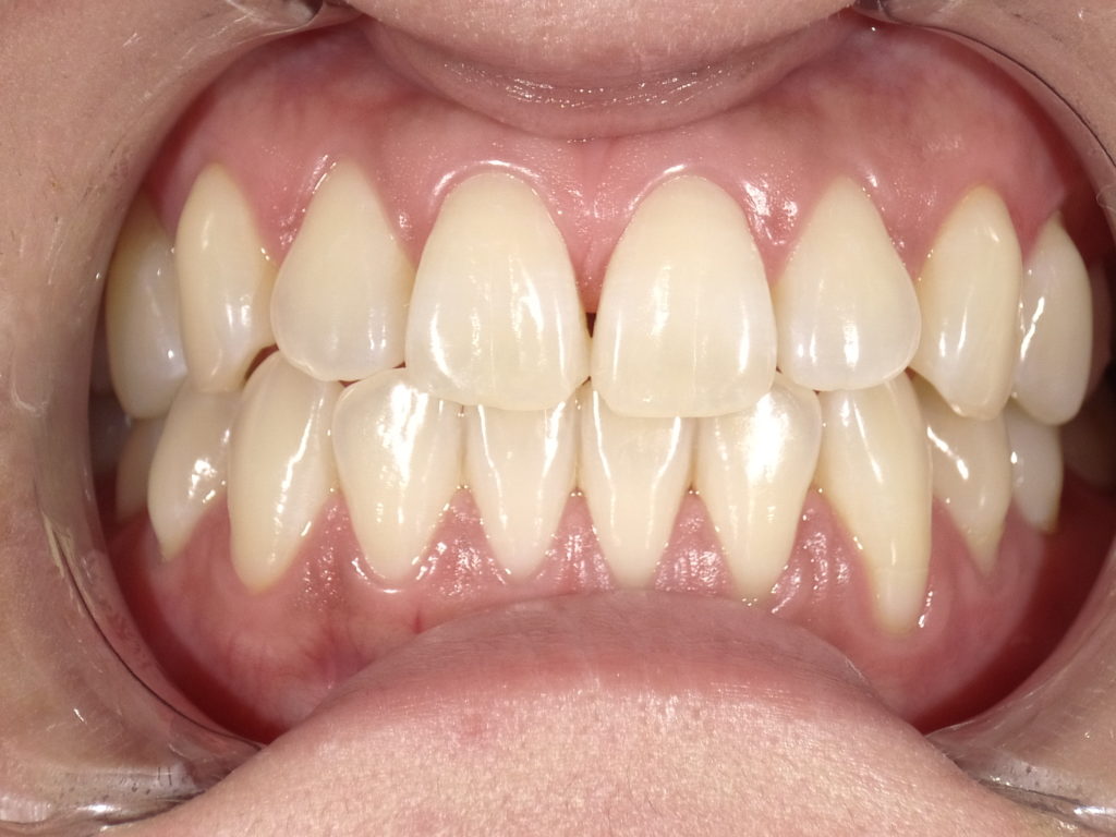 SHOFU DENTAL DIGITAL CAMERA | ひろし歯科