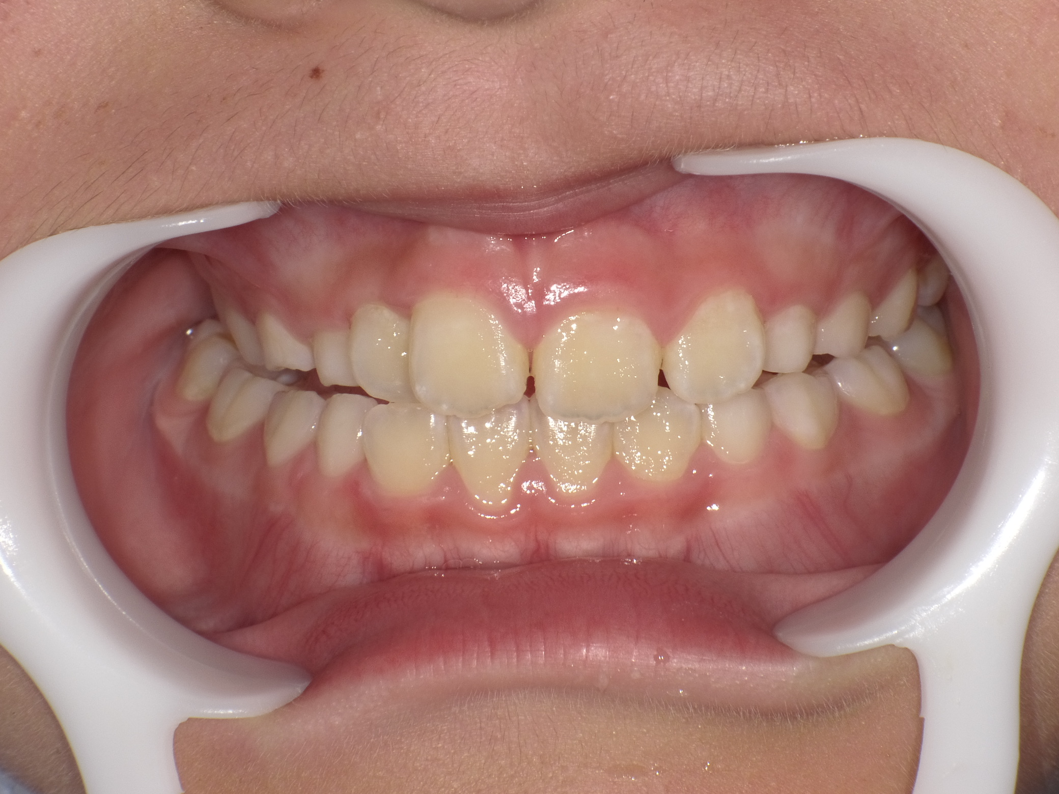 SHOFU DENTAL DIGITAL CAMERA | ひろし歯科